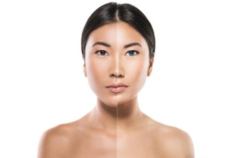 Jaw Surgery for the Perfect V-Line: Dispelling Myths 2024