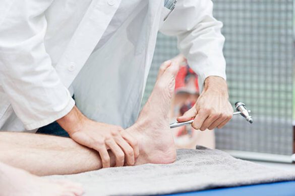 Approaches to Babinski Reflex in 2024. - Medspurs