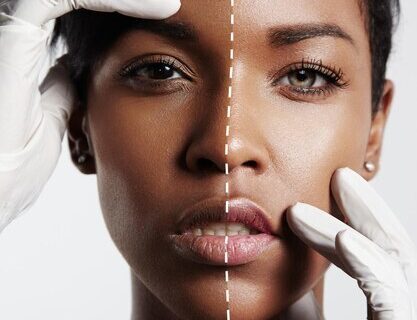 Broken Hymen & Virginity: Medical Facts vs. Myths (Expert Insights)