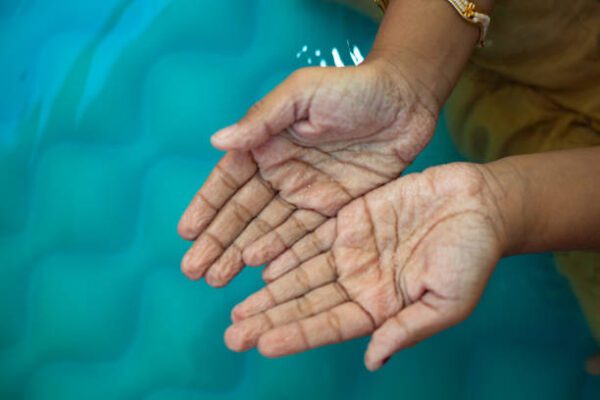 Pruney Fingers: Why They Happen, When to Worry, and Doctor-Backed Fixes