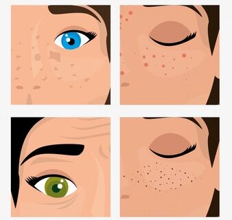 What Is Autistic T-Rex Arm and Why Do Some People Have It? - Medspurs