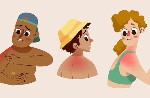 Understanding Autistic T-Rex Arm: Full Guide & Tips